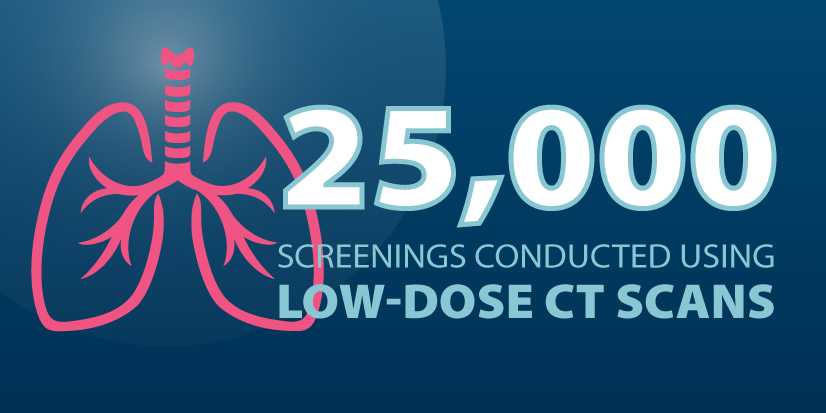 Independence Health System Screens for Lung Cancer with 25,000 Low-Dose ...