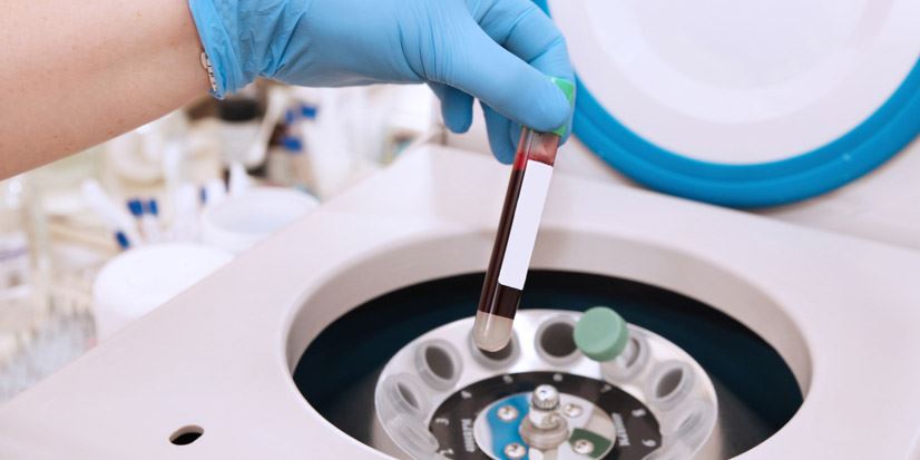 Platelet Rich Plasma (PRP) Therapy at Independence Health System