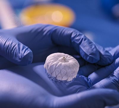 WATCHMAN Procedure | Independence Health System